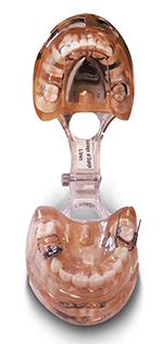 Space Maintenance Dental Model | College of DuPage Library