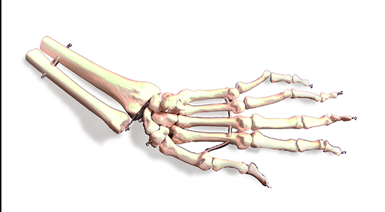 Hand Skeleton | College of DuPage Library